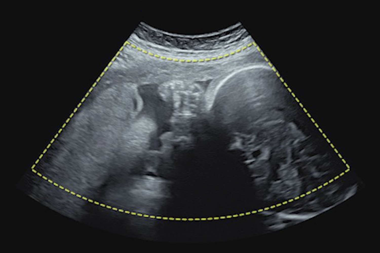 3D/4D ultrasound - Crystal Speirs Photography